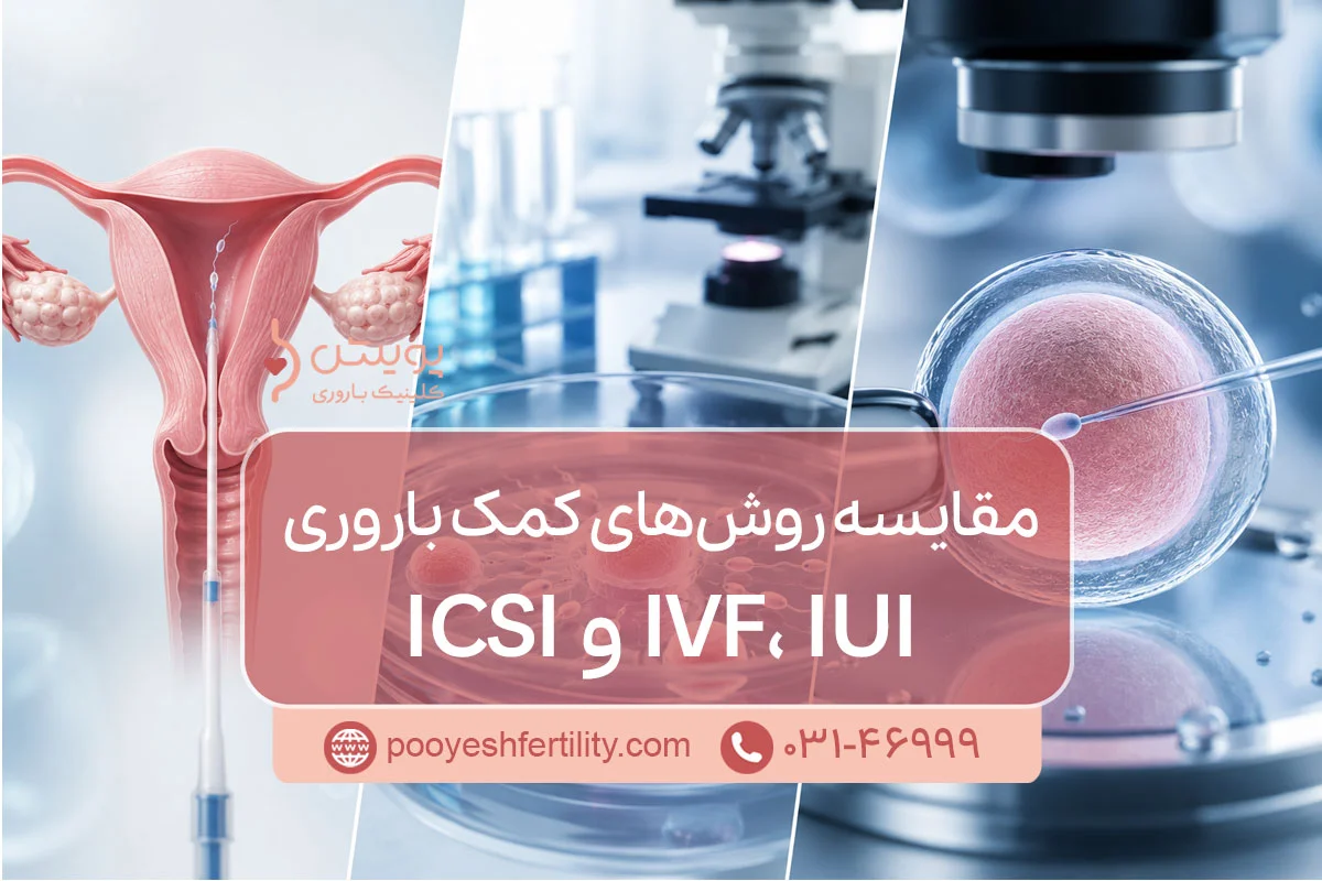 مقایسه IVF، IUI و ICSI | انواع روش های کمک باروری و هزینه ها